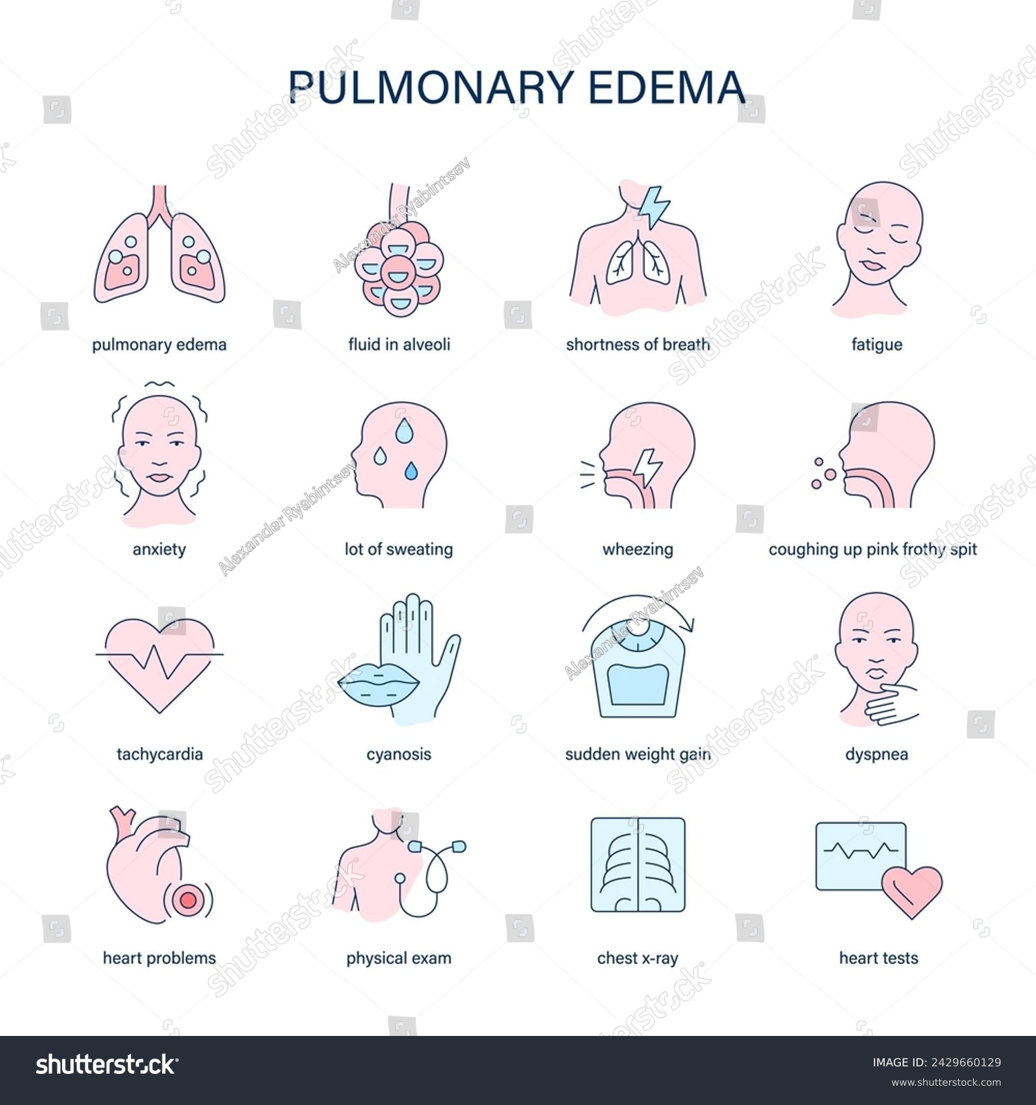 Pulmonary Edema symptoms, diagnostic and - Royalty Free Stock Vector ...