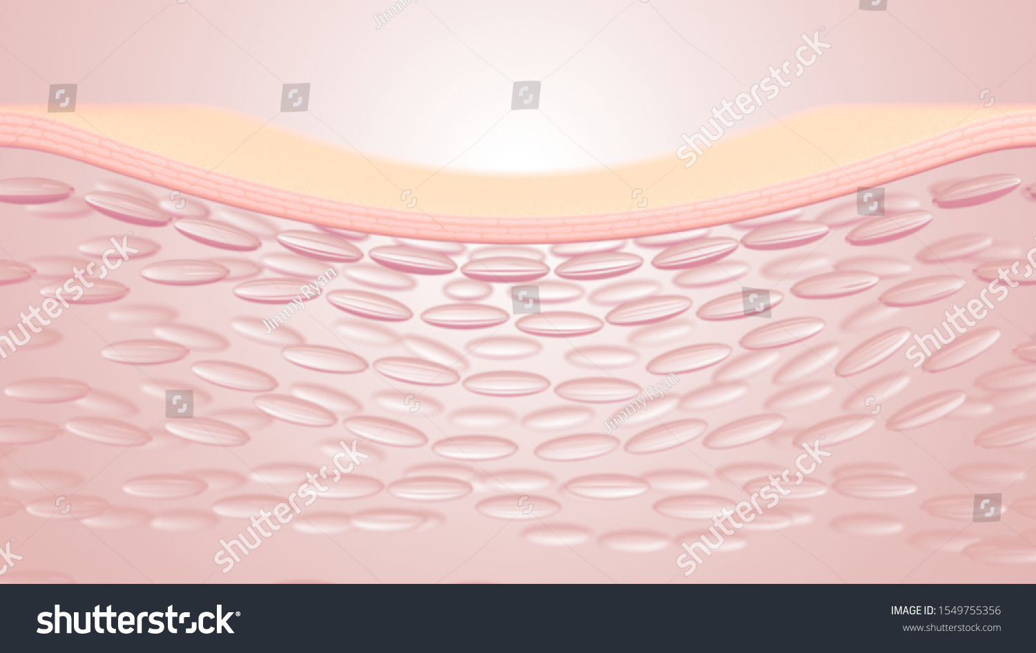 1,812 Subcutaneous tissue Images, Stock Photos & Vectors | Shutterstock