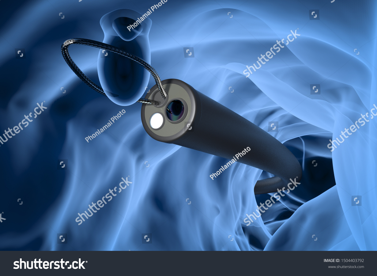 448 Polyp removal Images, Stock Photos & Vectors | Shutterstock