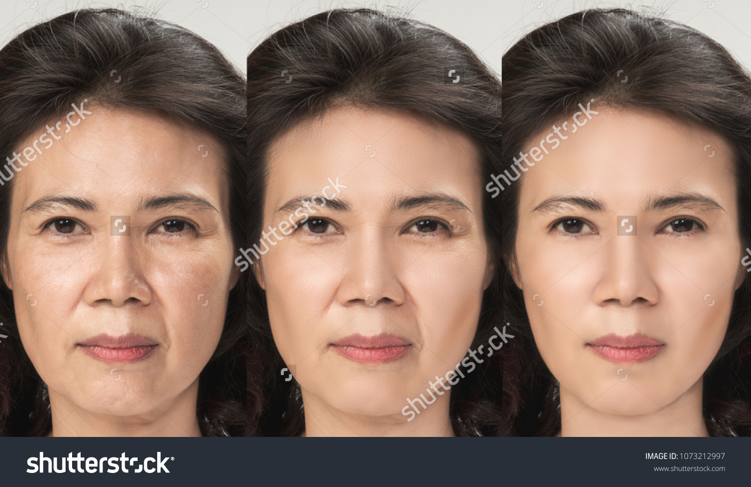 Anti Aging Process Asian Woman Face Stock Photo 1073212997 | Shutterstock Anti Aging Process Asian Woman Face Stock Photo 1073212997 | Shutterstock