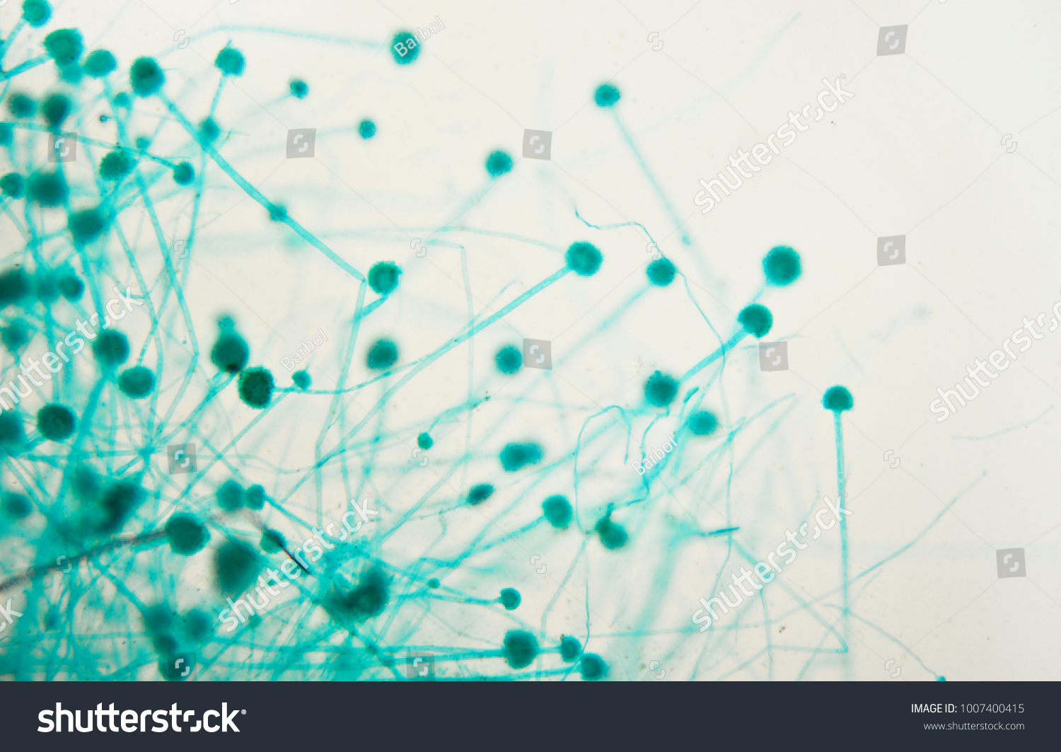 Aspergillus Under Microscope Stock Photo (Edit Now) 1007400415