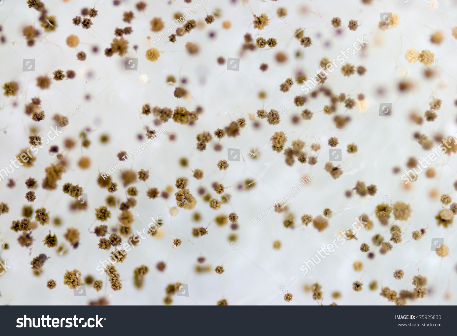 Aspergillus Under Microscope View Stock Photo 475925830 - Shutterstock