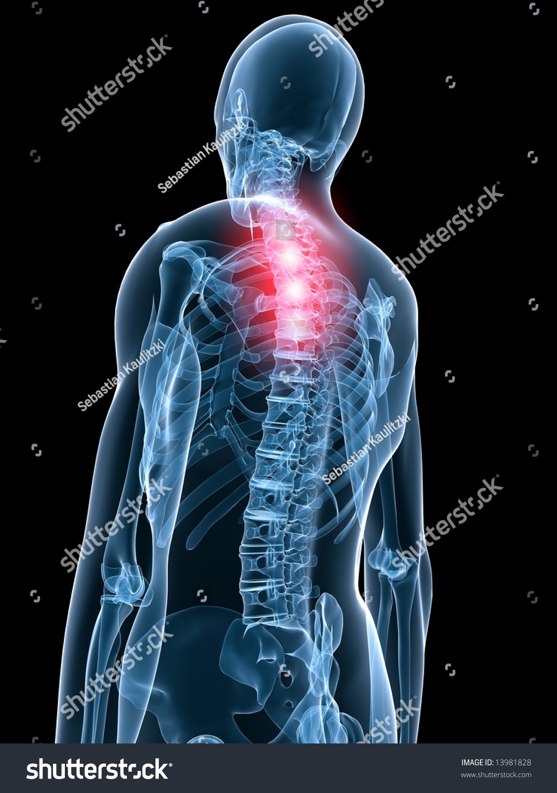 Backache Stock Illustration 13981828 | Shutterstock