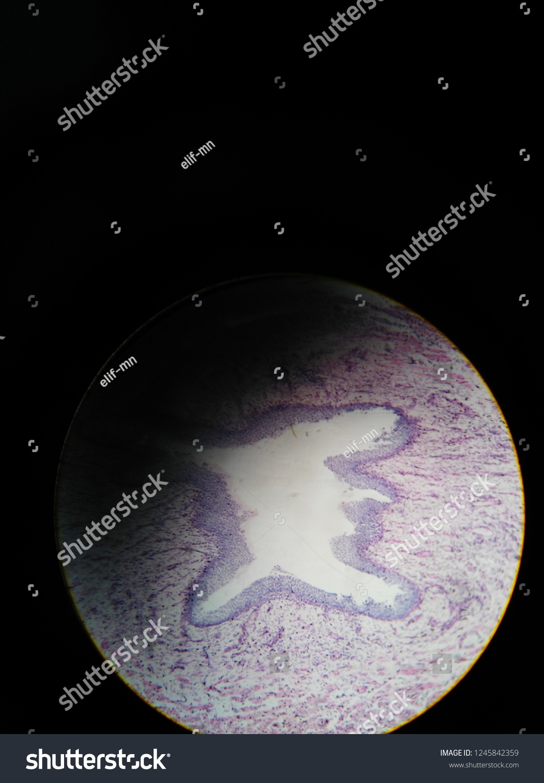 Bladder On Microscope View Stock Photo 1245842359 | Shutterstock