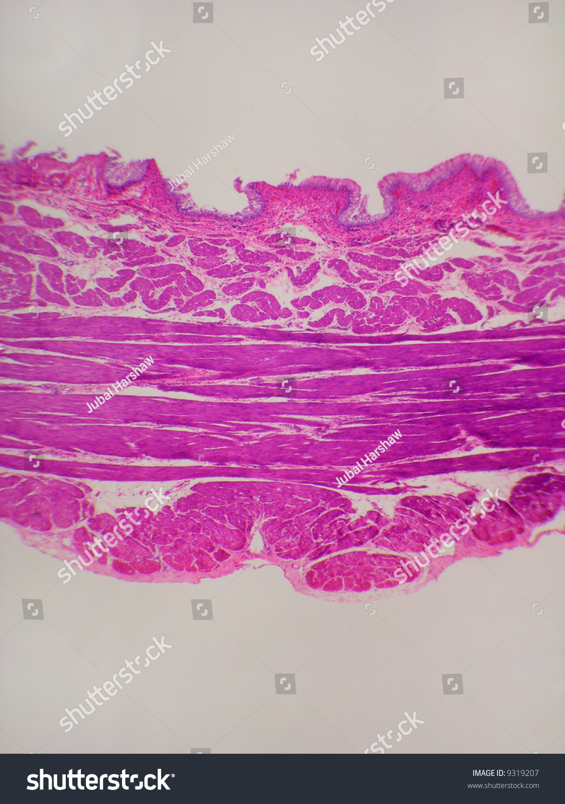 Bladder Tissue Cross Section Foto Stok 9319207 | Shutterstock