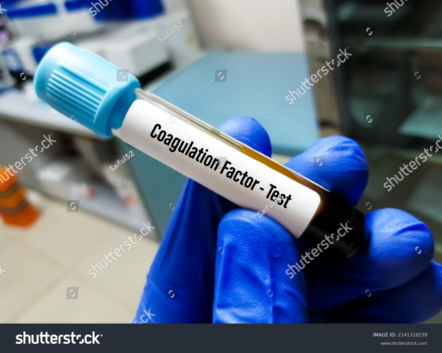 Blood Sample Coagulation Factor Testing Stock Photo 2141318239 ...