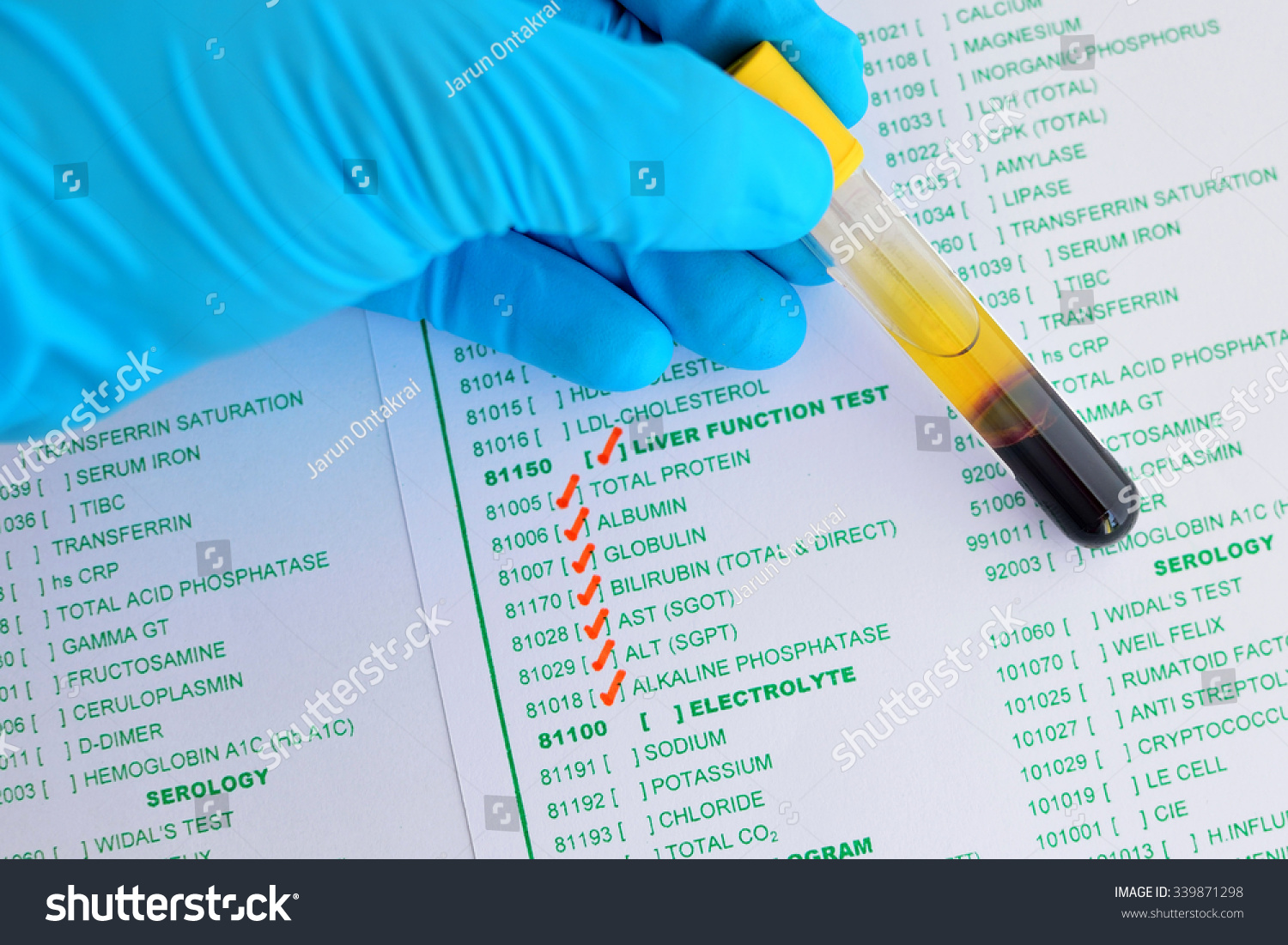 Blood Sample Liver Function Test Stock Photo (Edit Now) 339871298