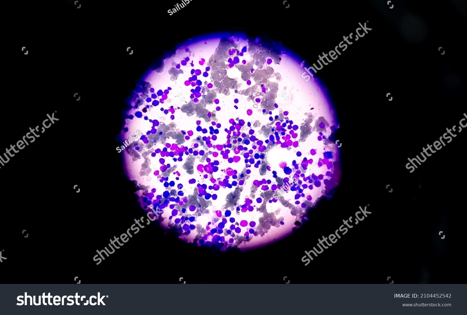 Bone Marrow Analysis Under Microscope Stock Photo (Edit Now) 2104452542