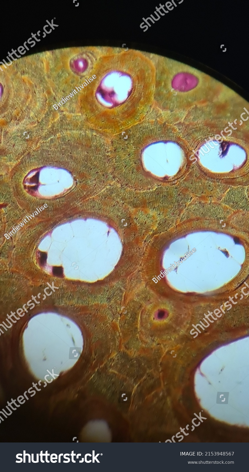 Bone Tissue Structure Under Microscope Stock Photo 2153948567 ...