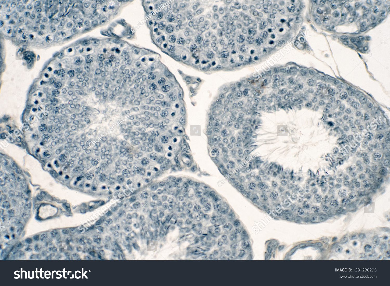 Cross Section Human Testis Under Microscope Foto Stock Editar Agora