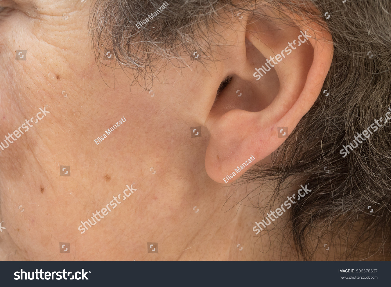 17 Parotid lymph nodes Images, Stock Photos & Vectors | Shutterstock 17 Parotid lymph nodes Images, Stock Photos & Vectors | Shutterstock