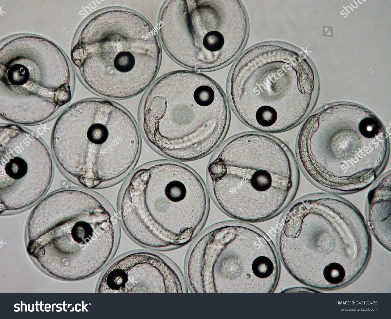 Developing Fish Eggs Under Light Microscope Stock Photo 342163475 ...