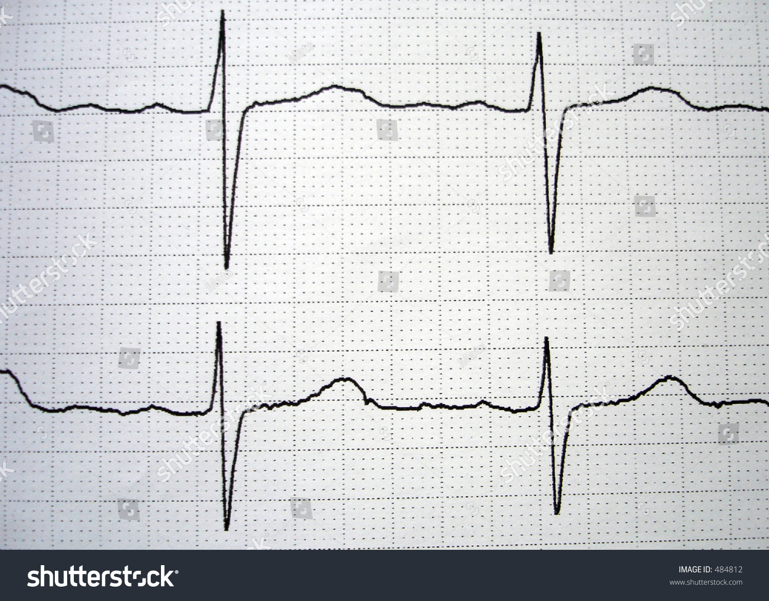 Ekg Electrocardiogram Stock Photo (Edit Now) 484812
