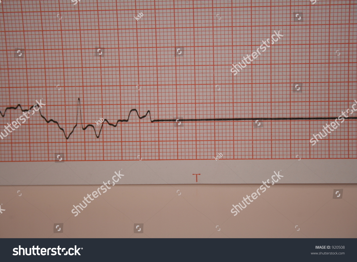 Ekg Flatline Stock Photo 920508 - Shutterstock