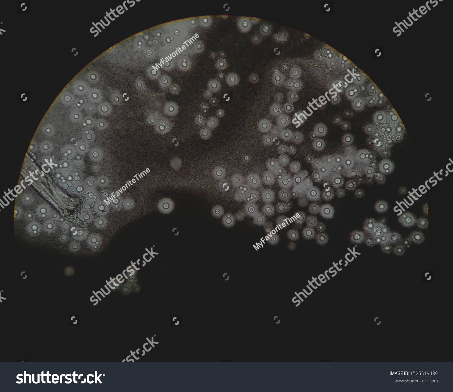 Encapsulated Yeast Budding Yeast Cells Under Stock Photo (Edit Now ... Encapsulated Yeast Budding Yeast Cells Under Stock Photo (Edit Now ...
