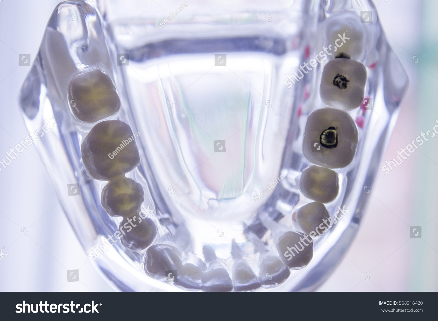 False Teeth Sample Dentists Stock Photo 558916420 | Shutterstock