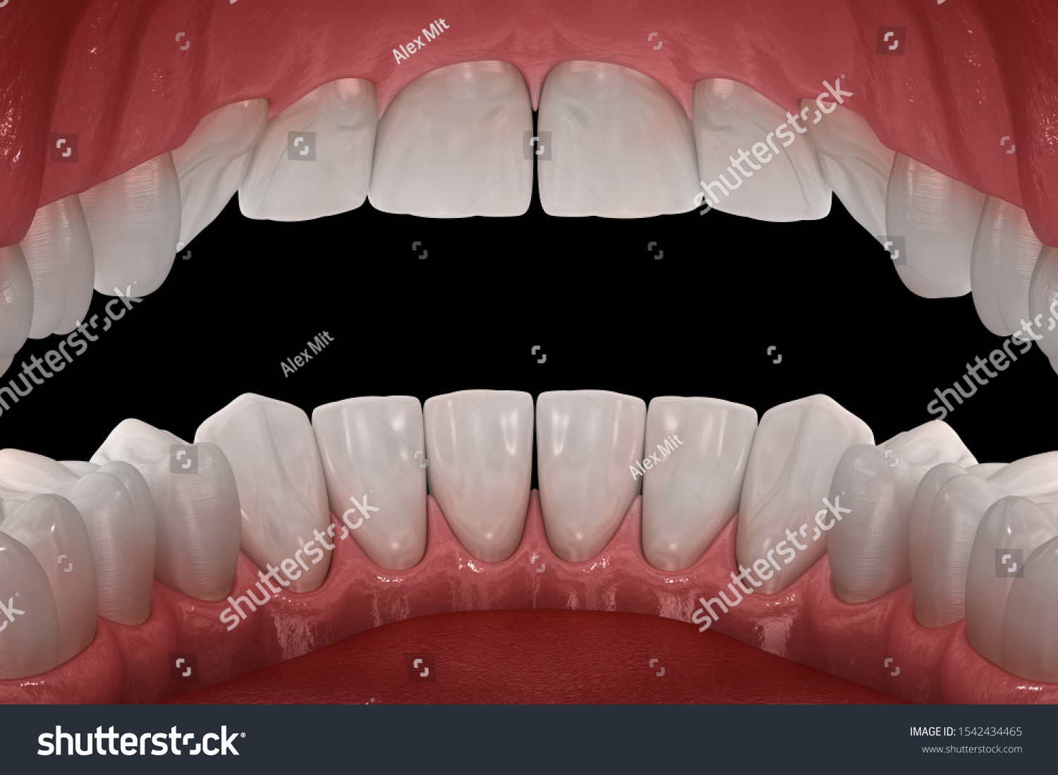 Healthy Human Teeth Normal Occlusion View Stock Illustration 1542434465 Healthy Human Teeth Normal Occlusion View Stock Illustration 1542434465