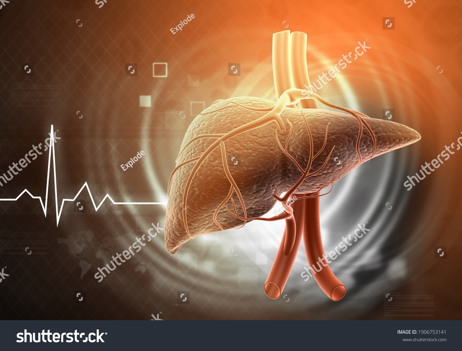 11693 Imágenes De Cirrosis Imágenes Fotos Y Vectores De Stock Shutterstock