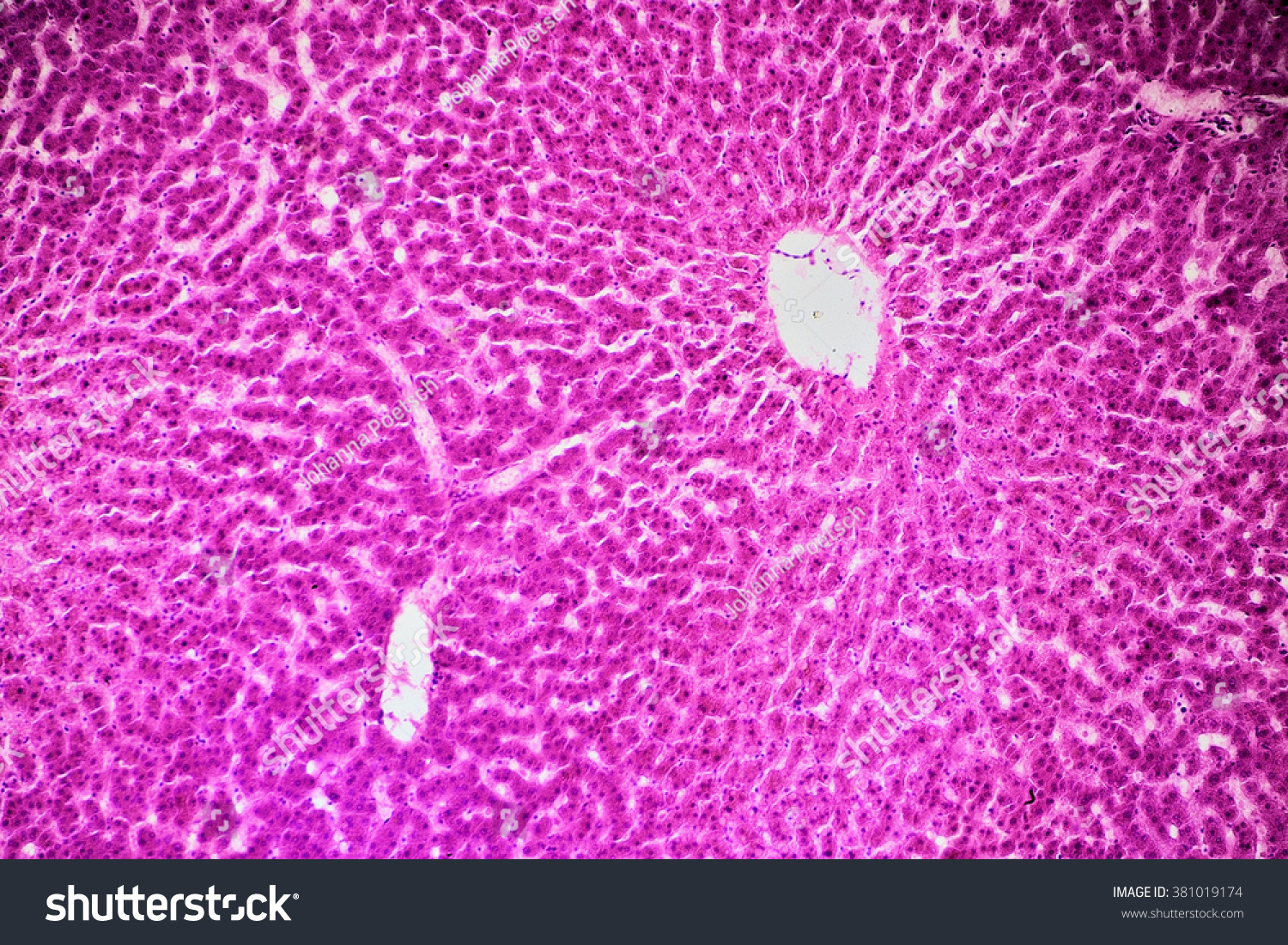 Human Liver Tissue Under Microscope Foto Stok 381019174 | Shutterstock