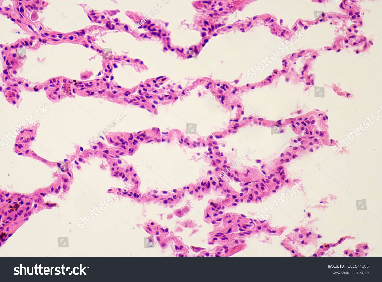 Human Lung Section Under Microscope Stock Photo 1282544086 | Shutterstock