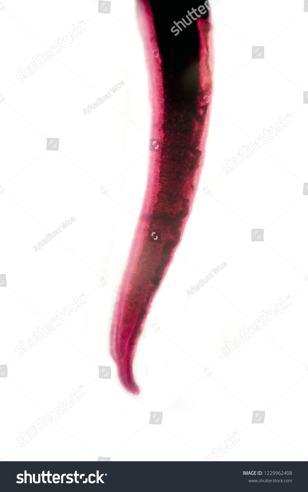 Human Worm Under Microscope Stock Photo 1229962408 | Shutterstock