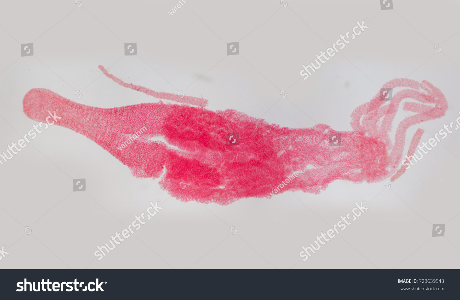 Hydra Under Microscope Stock Photo 728639548 | Shutterstock