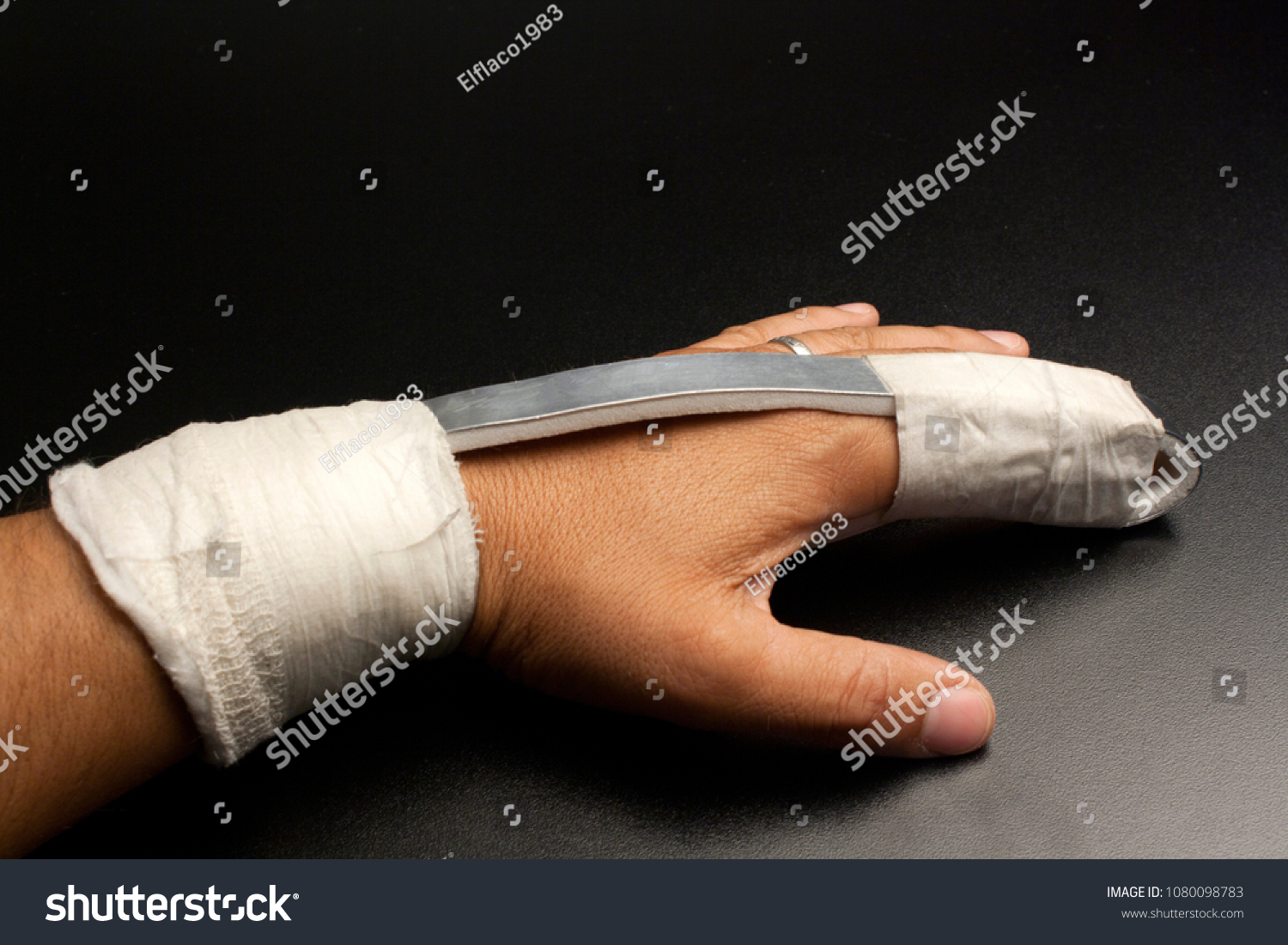 Man Broken Fingers Stock Photo (Edit Now) 1080098783