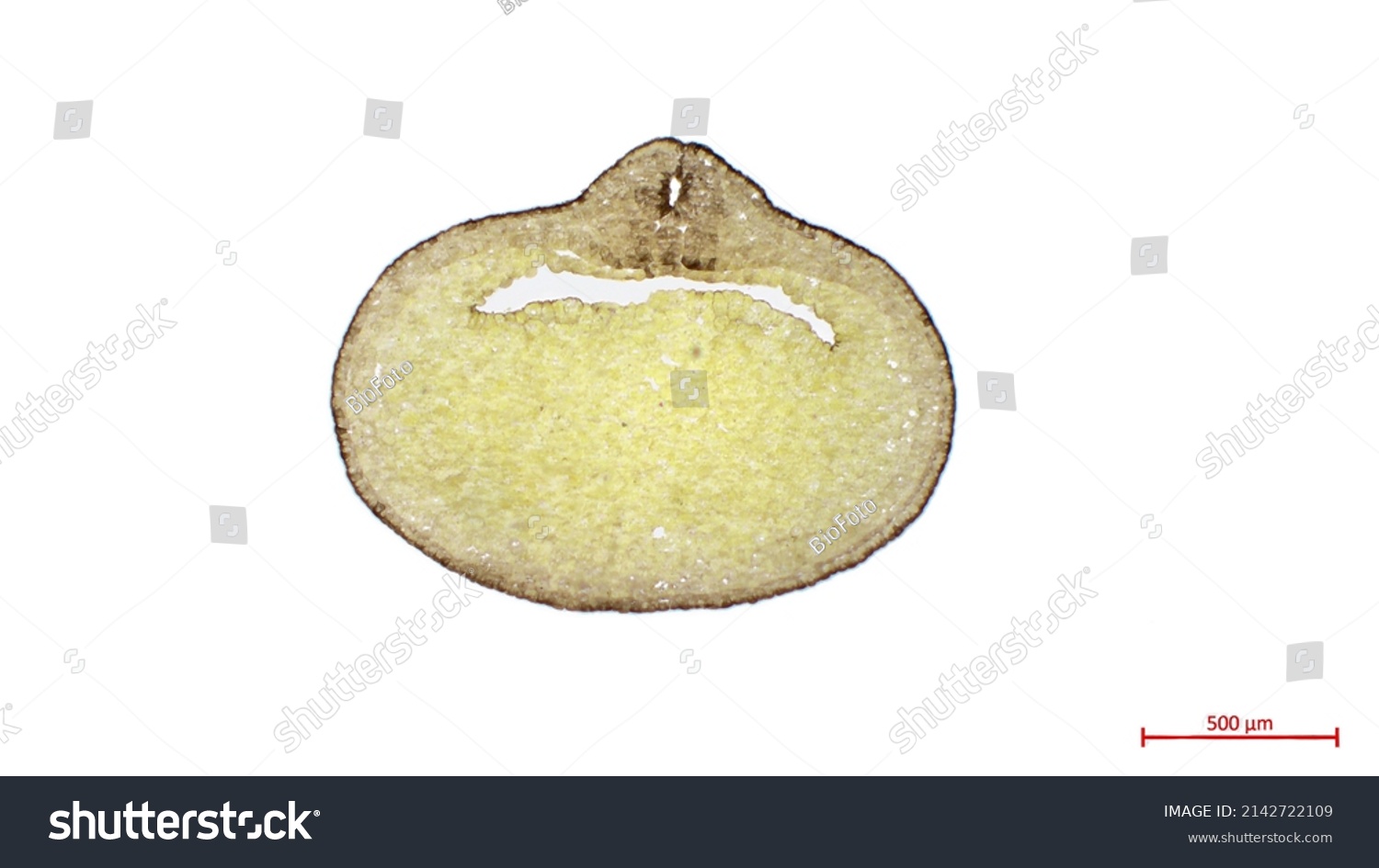 Neurulation Light Micrograph Developing Frog Egg Stock Photo 2142722109 ...