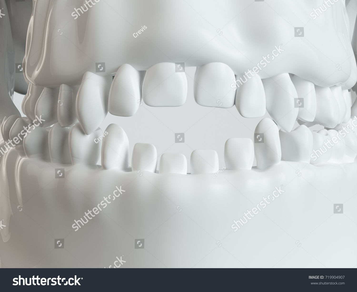 Open Bite By Pacifiers 3d Rendering Stock Illustration 719904907