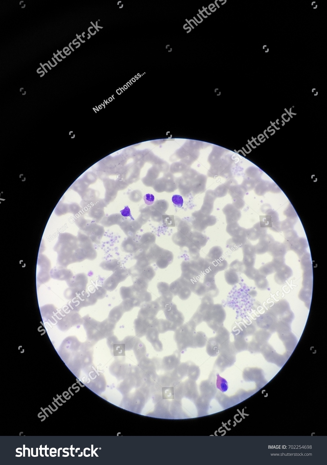 Platelets Clumping Stock Photo 702254698 | Shutterstock