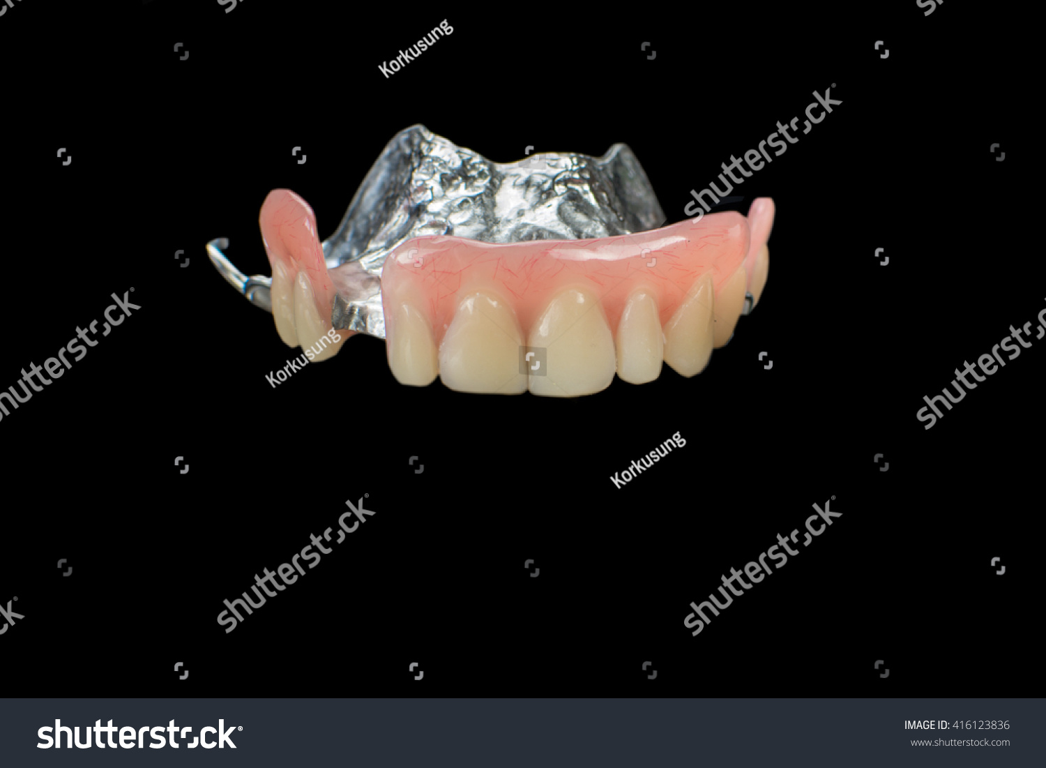 Removable Partial Denture Stock Photo 416123836 | Shutterstock