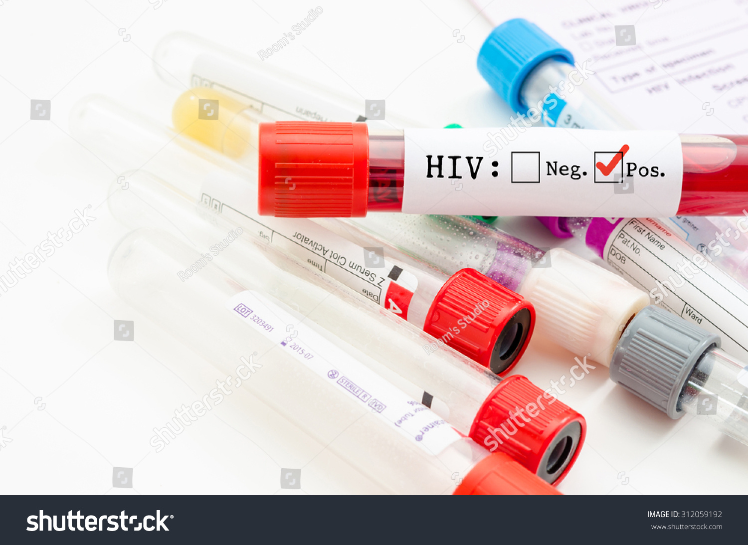Sample Blood Collection Tube Hiv Test Stock Photo 312059192 | Shutterstock Sample Blood Collection Tube Hiv Test Stock Photo 312059192 | Shutterstock