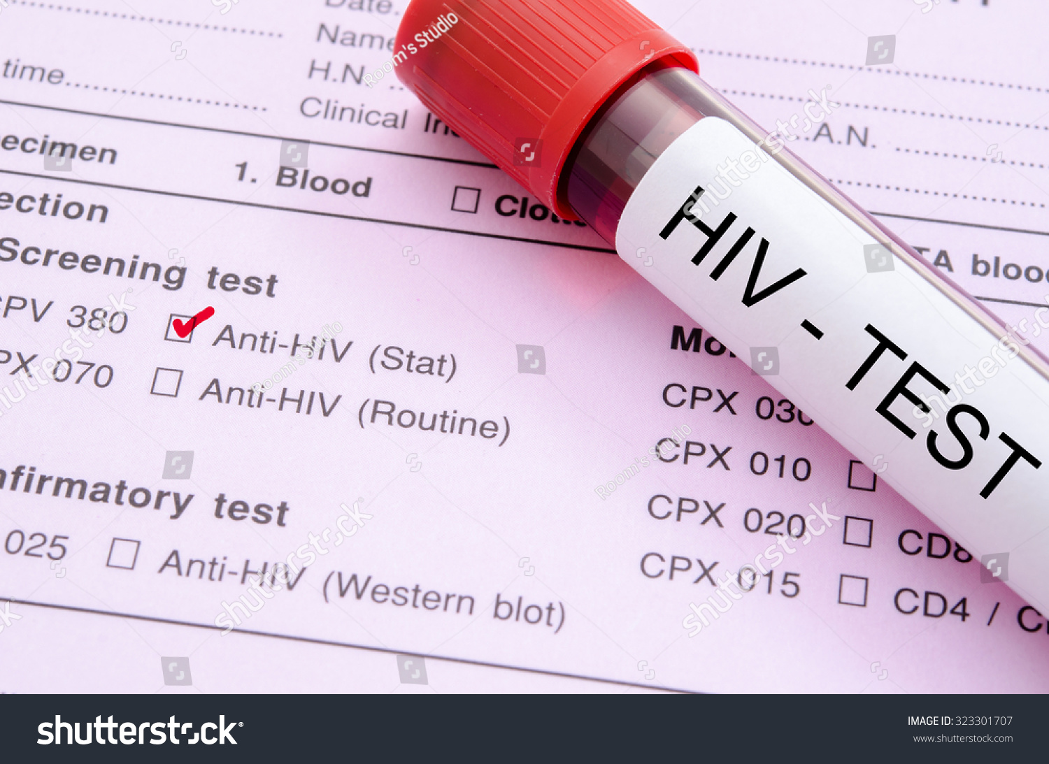 Sample Blood Collection Tube Hiv Test Foto Stok 323301707 | Shutterstock Sample Blood Collection Tube Hiv Test Foto Stok 323301707 | Shutterstock