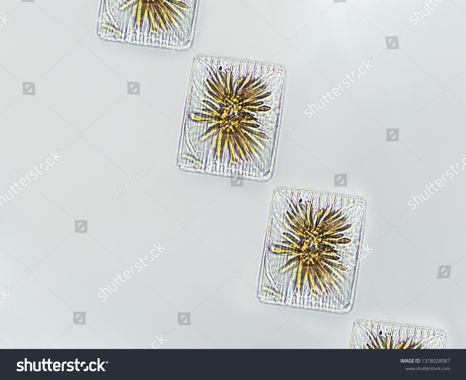 Striatella Unipunctata Algae Under Microscopic View Stock Photo (Edit ...