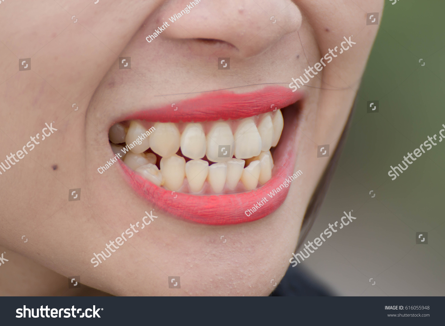 Teeth Stock Photo (Edit Now) 616055948
