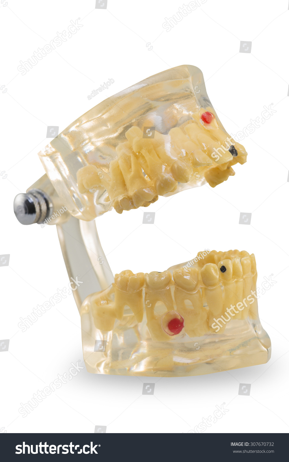 Tooth Development Model Tooth Eruption Model Stock Photo 307670732 ...