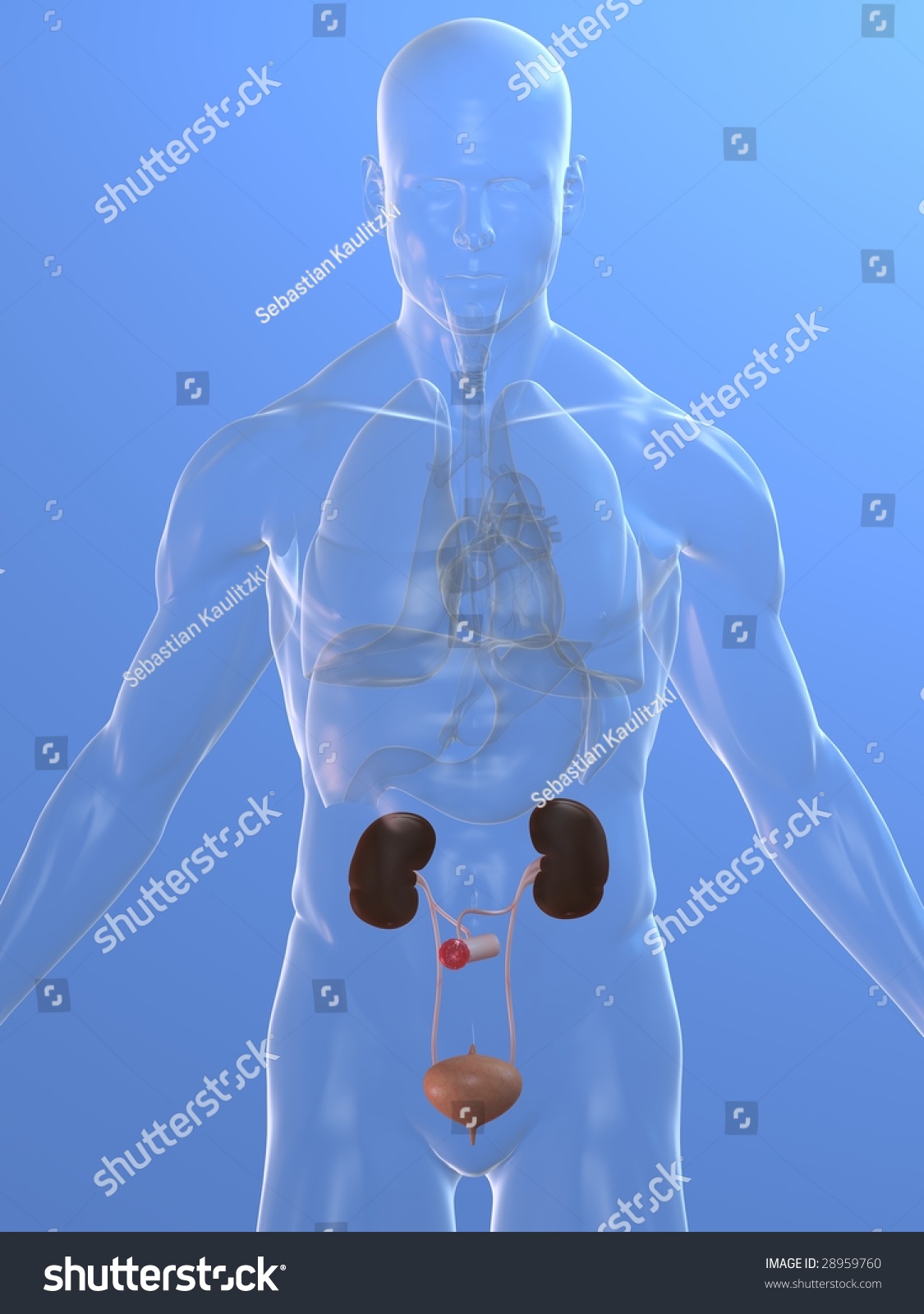 Urostomy Stock Illustration 28959760 | Shutterstock