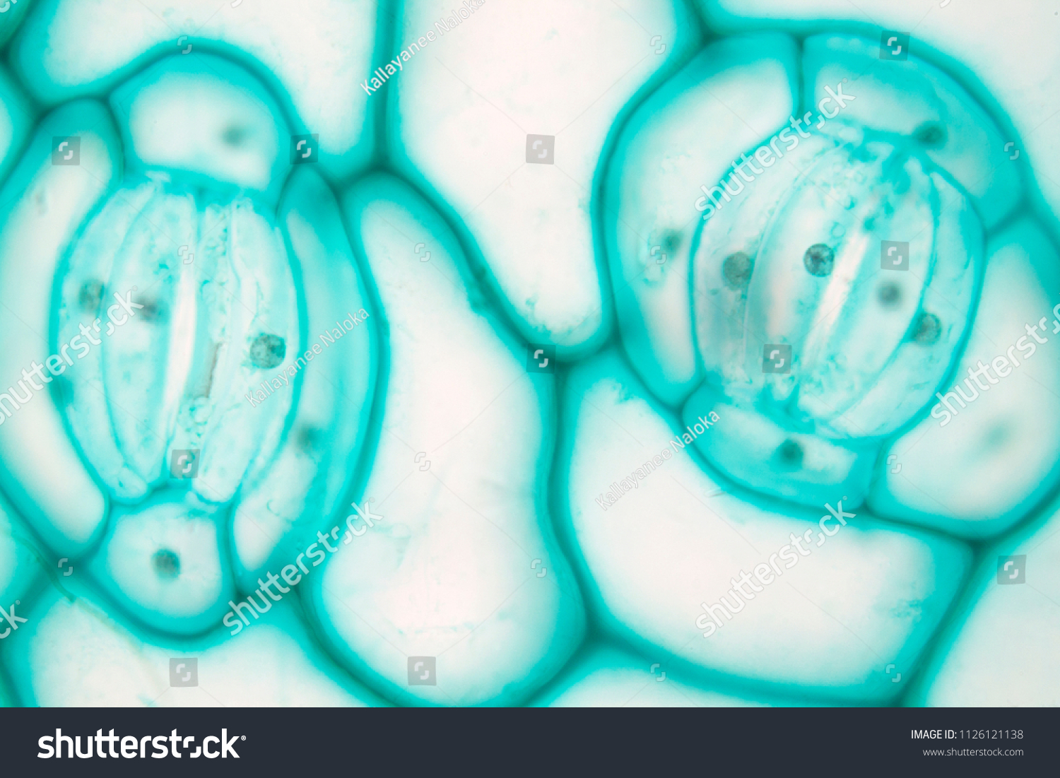 Venus Flytrap Stomata Under Microscope Stock Photo 1126121138 ...