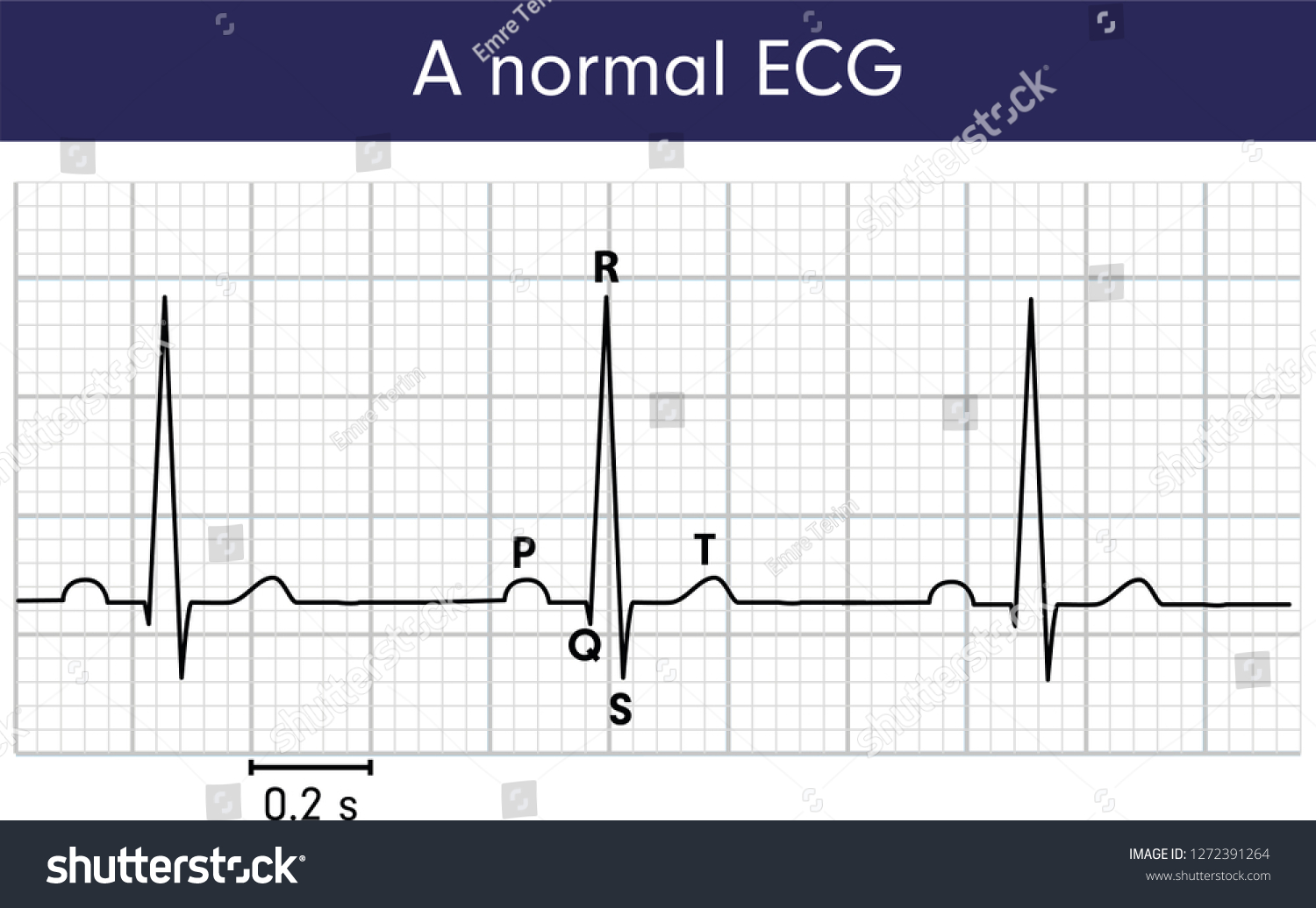 Normal Ecg Stock Vector (Royalty Free) 1272391264 | Shutterstock