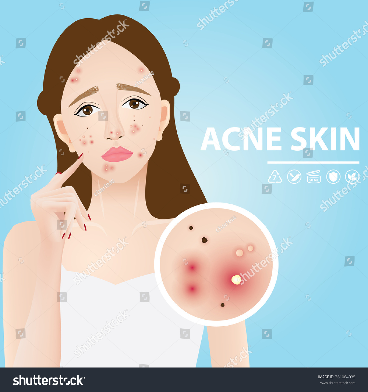 Acne Skin Vector Illustration Stock Vector (Royalty Free) 761084035
