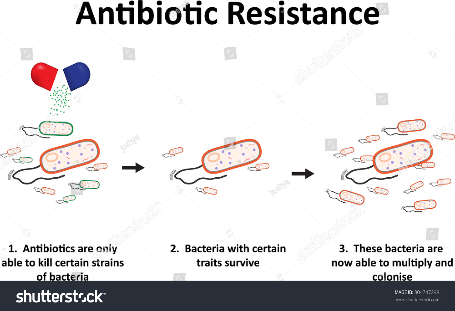 Antibiotic Resistance Stock Vector (Royalty Free) 304747298 - Shutterstock