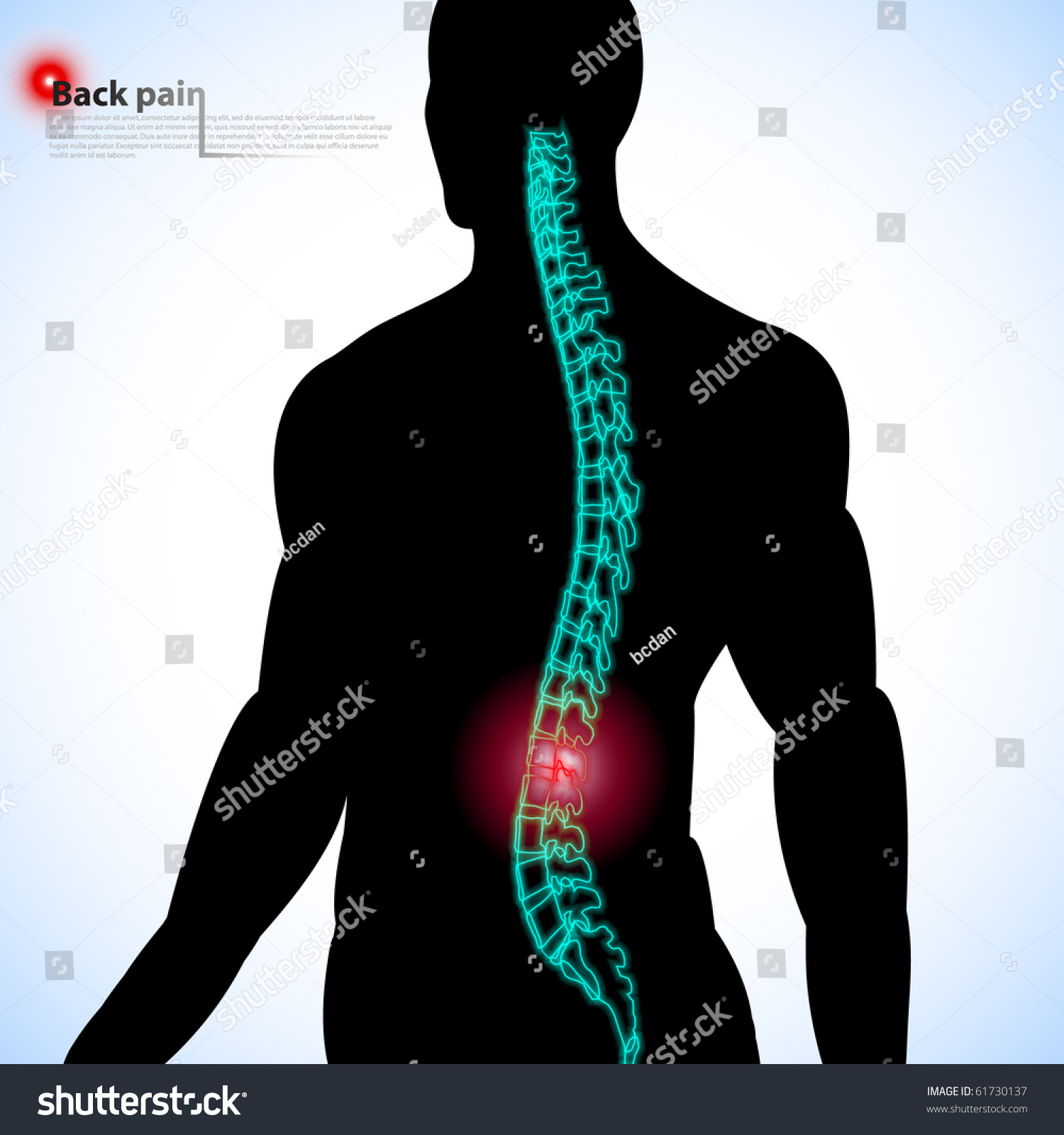 Back Pain Vector Illustration Stock Vector (Royalty Free) 61730137