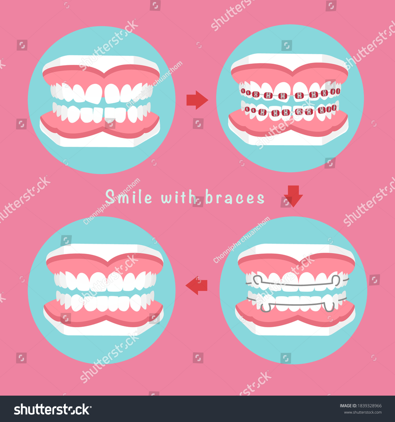 14,704 Smiling techniques Images, Stock Photos & Vectors | Shutterstock