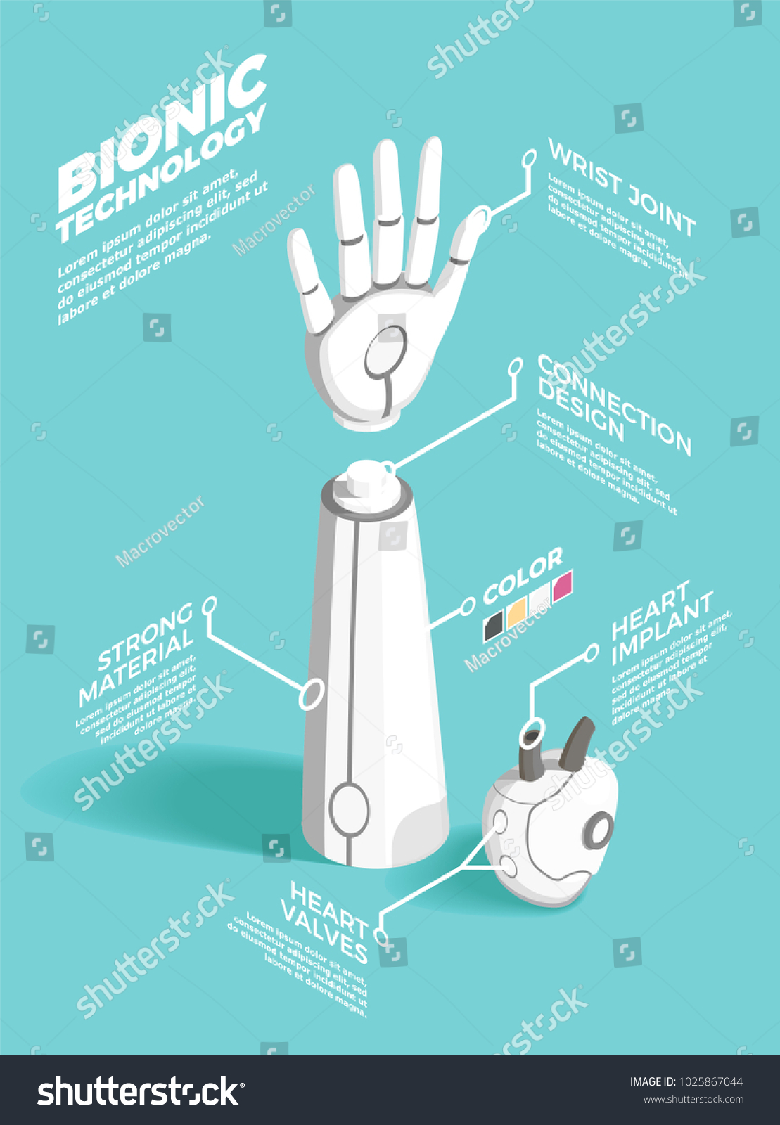 Bionics Technology Isometric Composition Illustrating Implants Stock ...