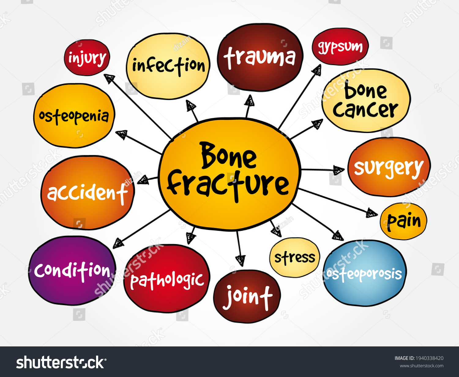Bone Fracture Mind Map Concept Presentations Stock Vector (Royalty Free ...
