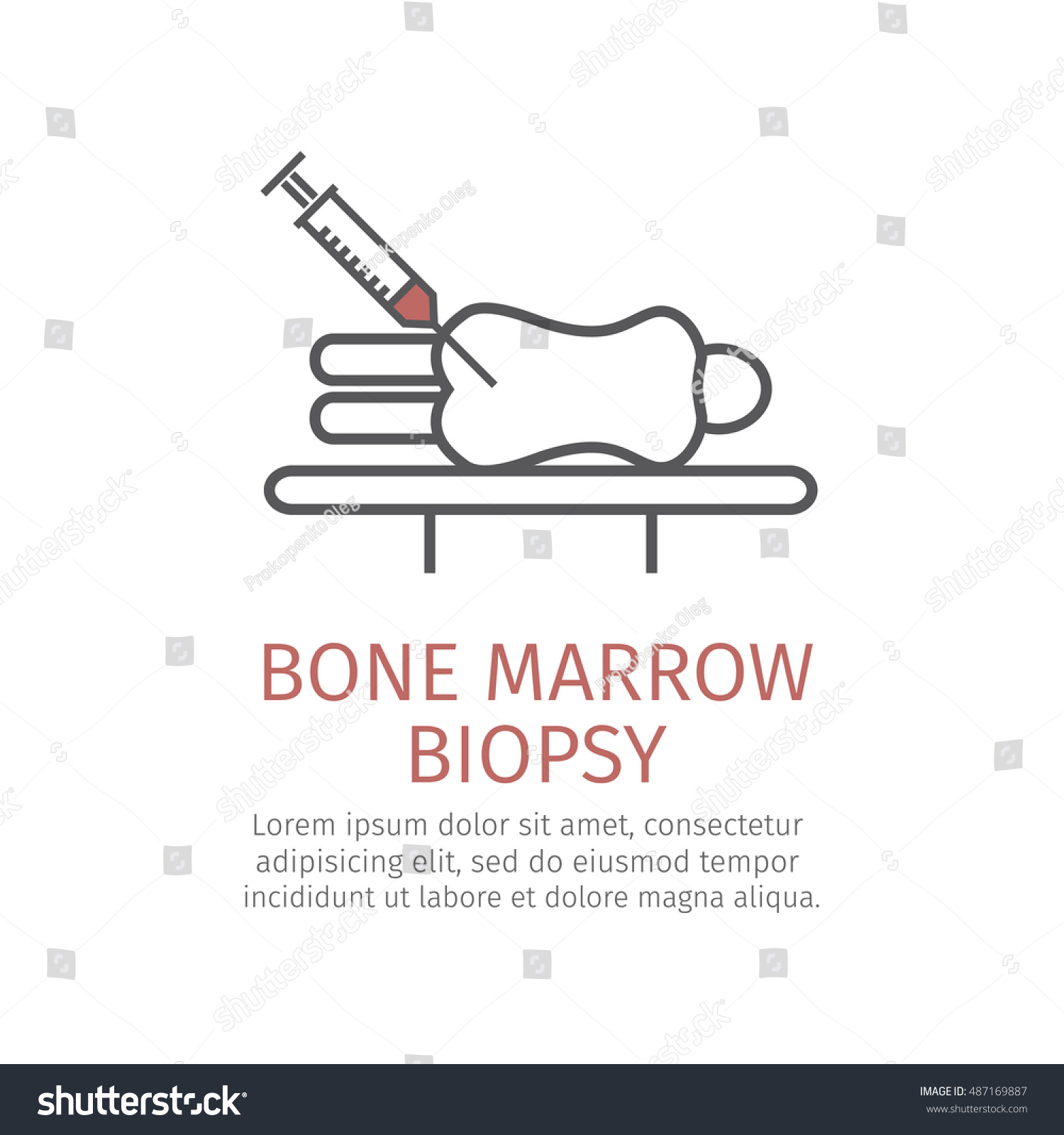 Bone Marrow Biopsy Vector Icon: เวกเตอร์สต็อก (ปลอดค่าลิขสิทธิ์) 487169887