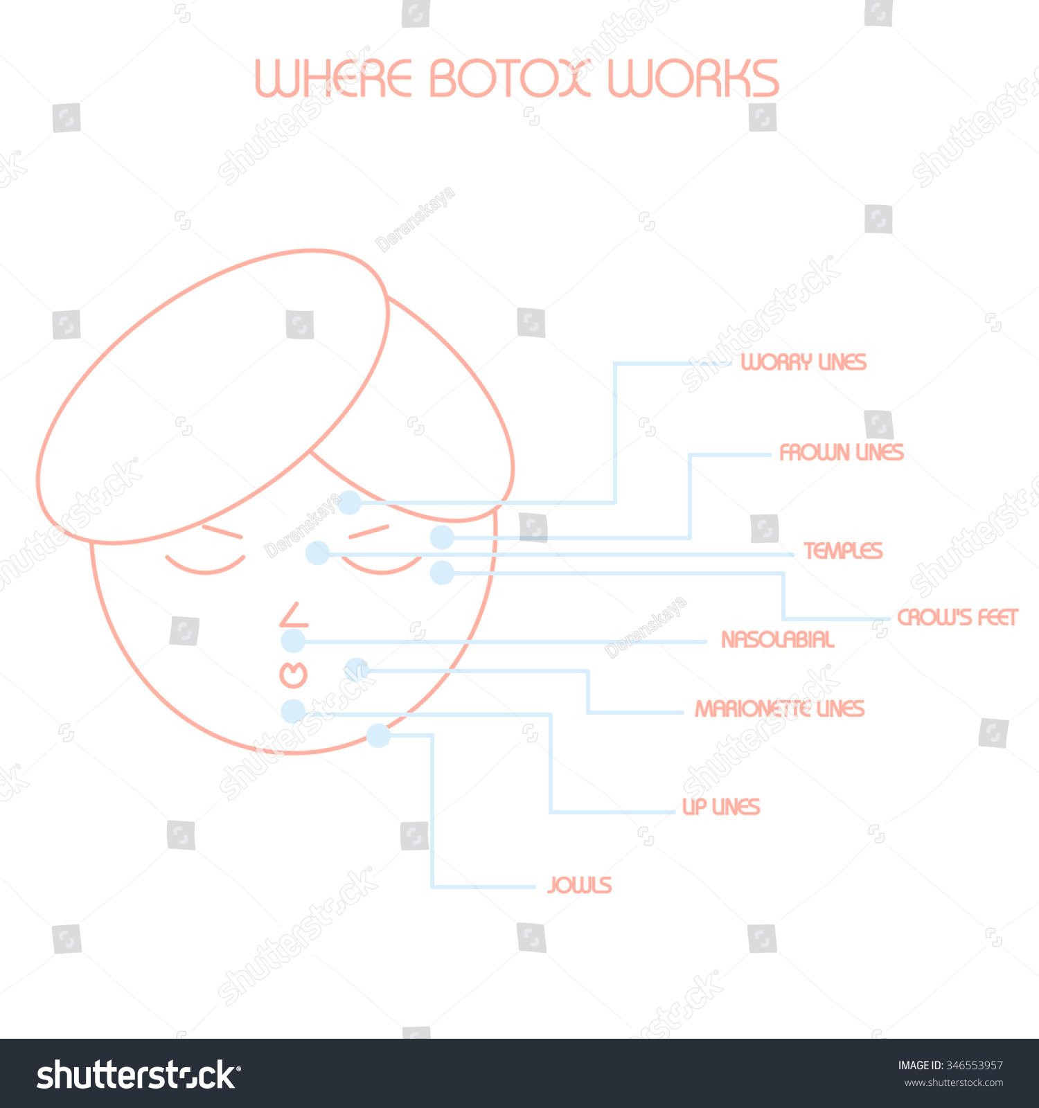 Botox Infographics. Vector Illustration. Flat Style Design. - 346553957 ...