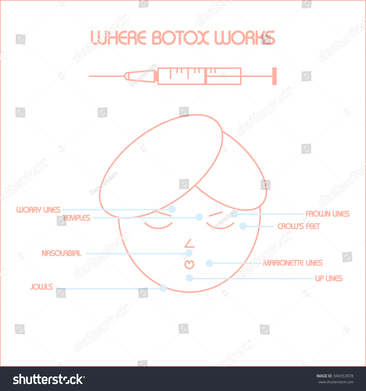 Botox Infographics Vector Illustration Flat Style Stock Vector (Royalty ...