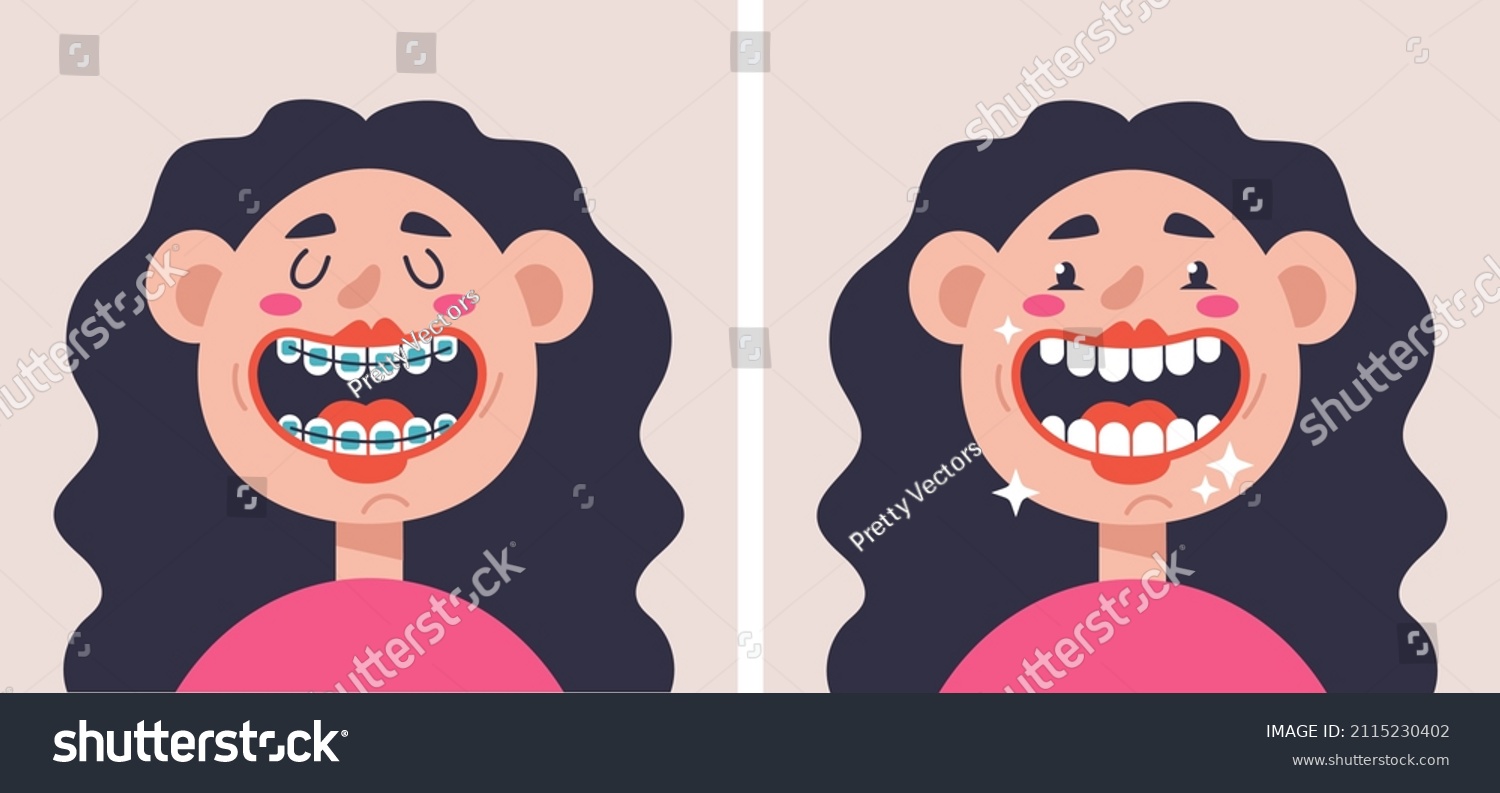 Bracket System Before After Concept Vector Stock Vector (Royalty Free ...