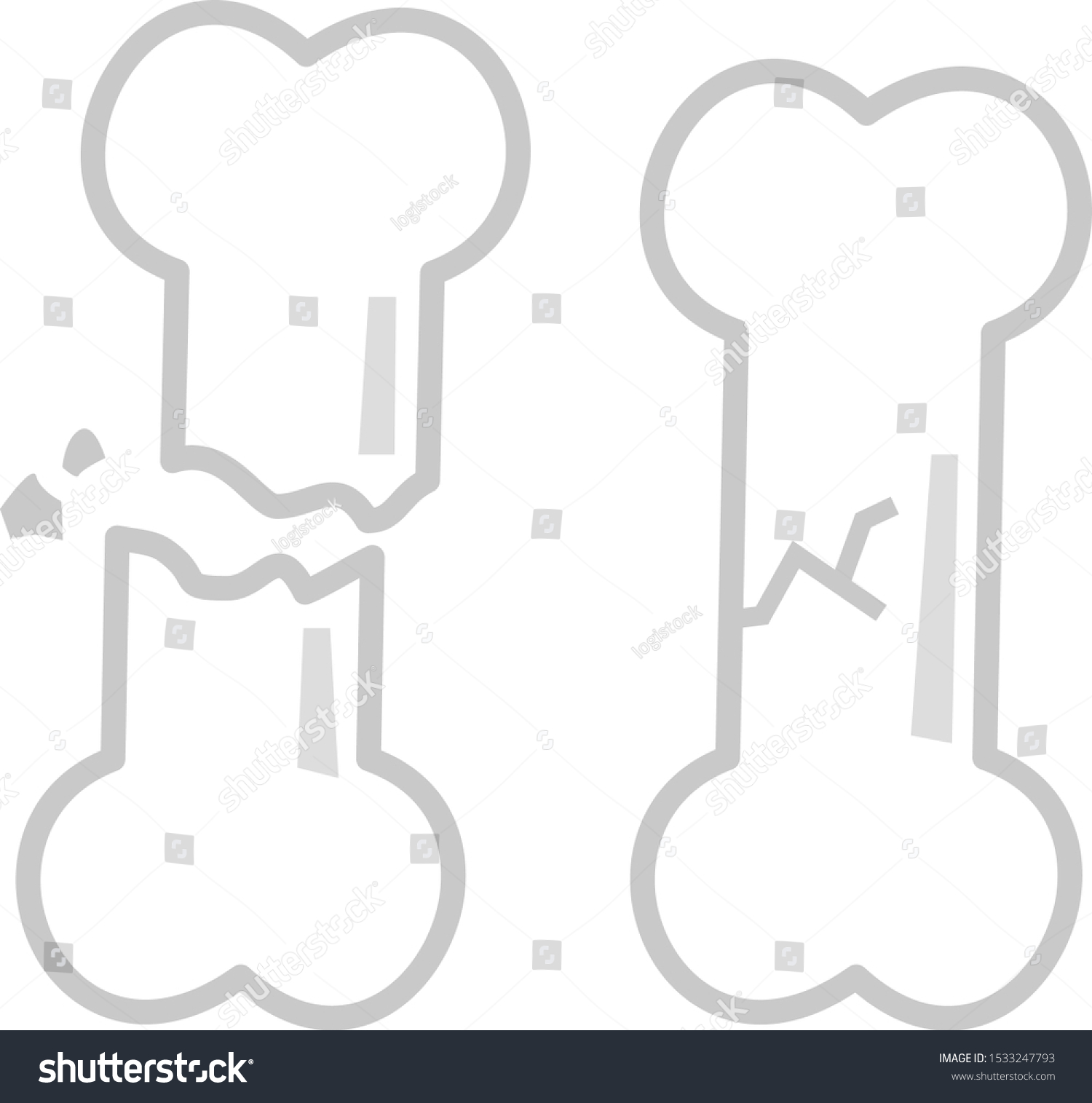 Broken Bone Cracked Bone Stock Vector (Royalty Free) 1533247793 ...